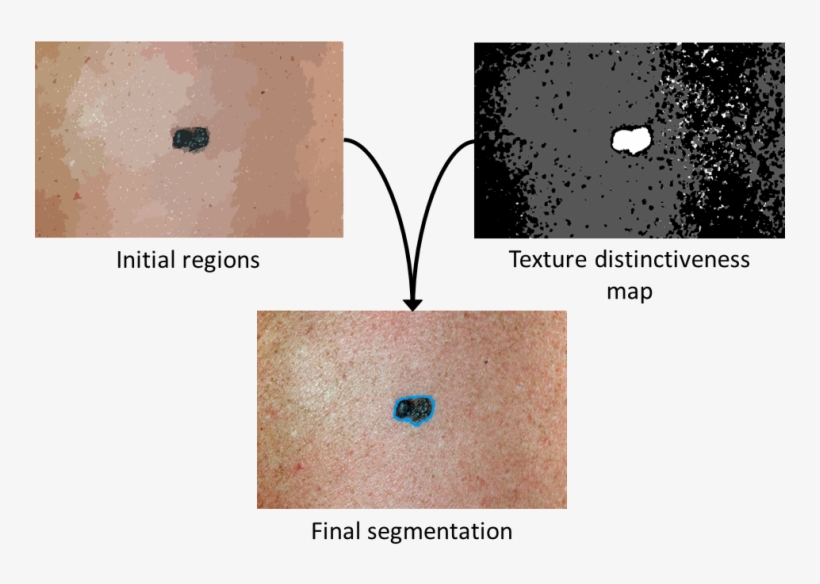 Flow Chart Showing The Steps To Calculate The Texture - Diagram ...