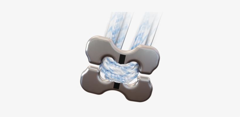 Dog Bone Button 0 Large - Arthrex Dog Bone Transparent PNG - 400x370 ...