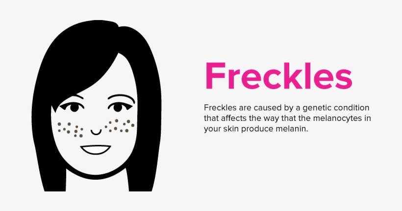 Download Freckles - Cartoon - HD Transparent PNG - NicePNG.com
