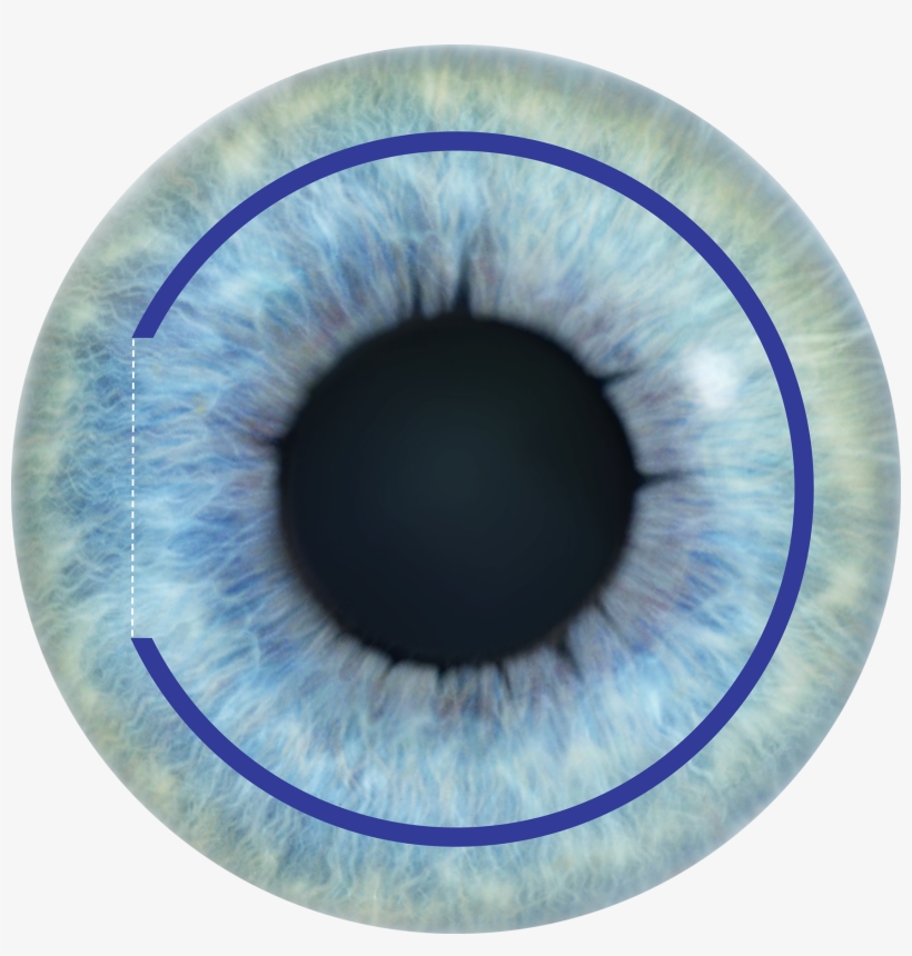 Lasik Transparent PNG - 1748x1748 - Free Download on NicePNG