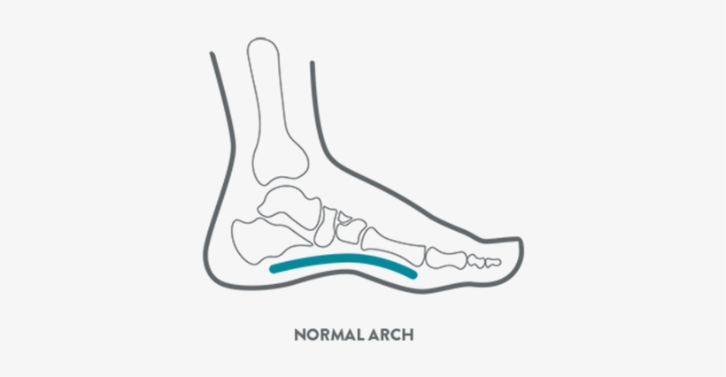 A Kids Foot Health Diagram Illustrating A Normal Arch - Illustration ...