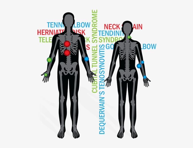 Spooky, Scary, Skeletons - Human Body Transparent PNG - 510x593 - Free ...