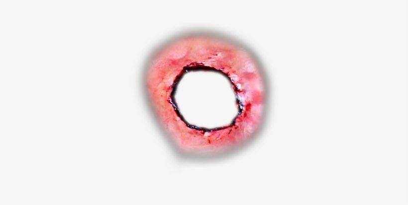 Download Wound Ferita Hole Blood Sticker By Go - Wound - HD Transparent ...