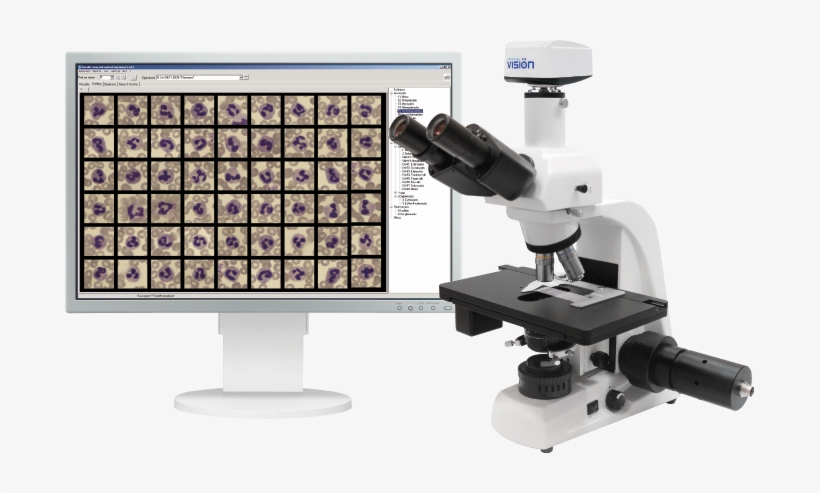 Vision Hema Automatic Digital Blood Smear Analysis - Hemavision ...