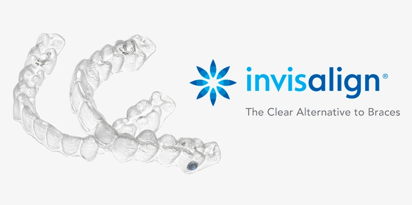 Braces-invisalign - Invisalign Aligners Transparent PNG - 934x328 ...