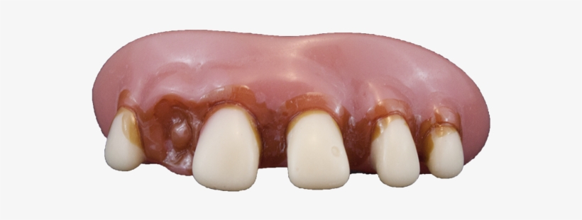 Free Clipart Buck Teeth