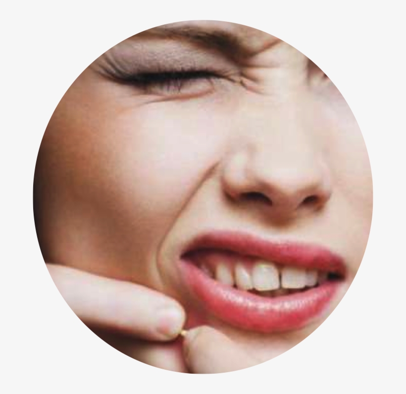 Acne Transparent PNG - 688x715 - Free Download on NicePNG