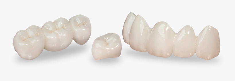 3m™ Espe™ Lava™ - 3m Lava Crowns Transparent PNG - 758x400 - Free ...