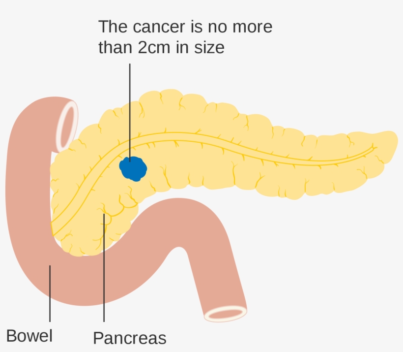 Download Open - Pancreas Svg - HD Transparent PNG - NicePNG.com