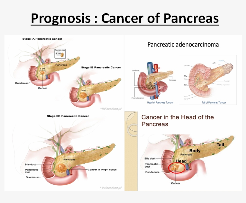 Prognosis Transparent PNG - 900x624 - Free Download on NicePNG