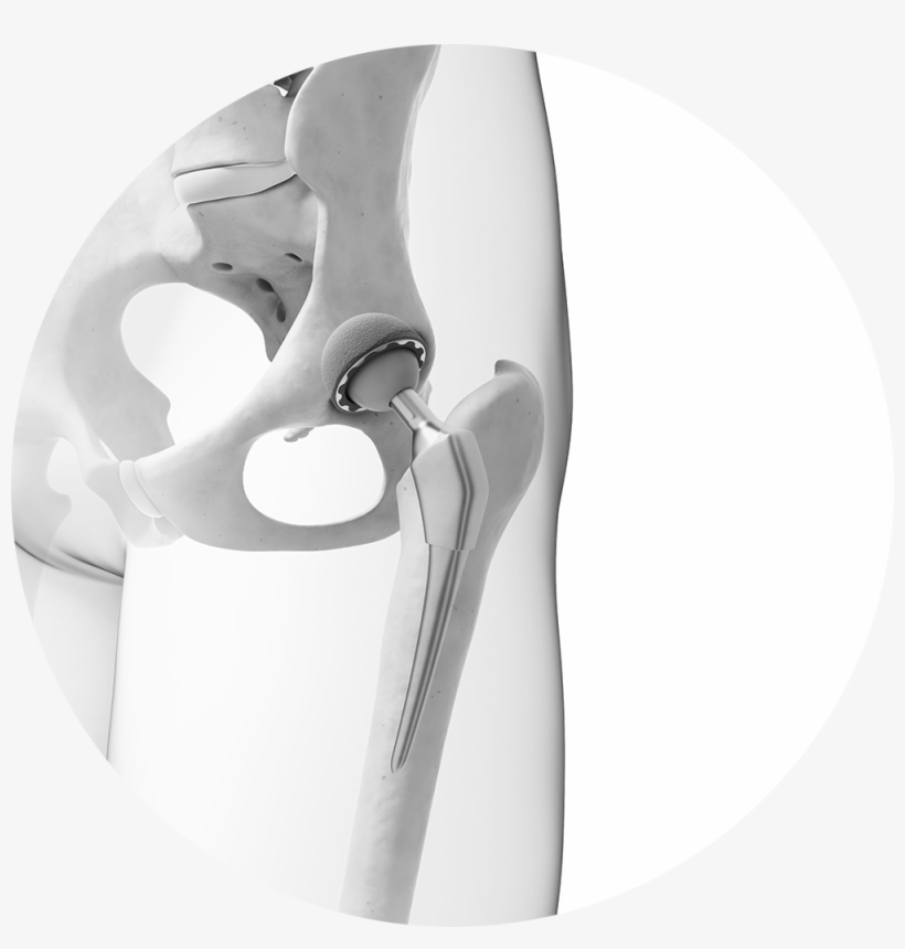 Img Hip Transparent PNG - 1000x1000 - Free Download on NicePNG