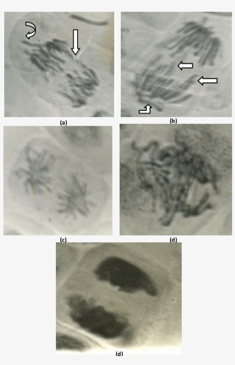 Abnormal Anaphase Cells Showing - Chromosome Transparent PNG - 850x1291 ...