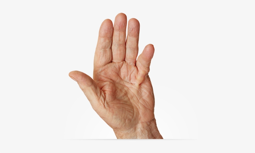 Download If Your Patient Can't Lay Their Hand Flat On A Table - Sign ...