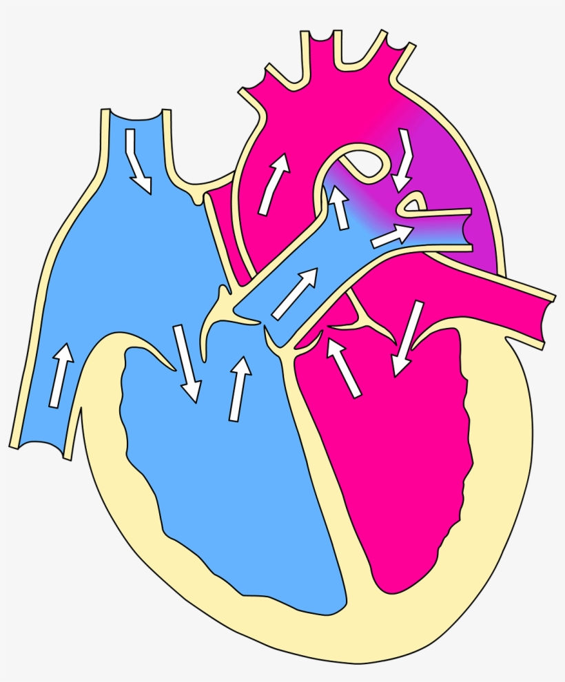 Simple Diagram Of Patent Ductus Arteriosus Transparent PNG - 1104x1280 ...