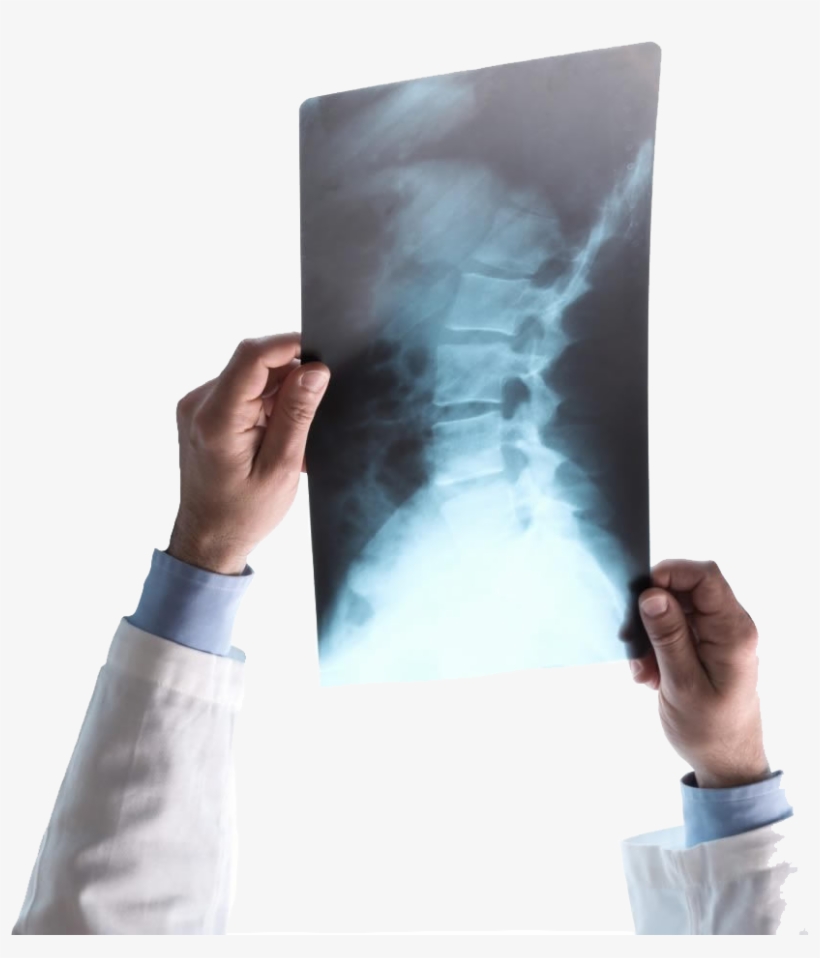 About Southwest X-ray - Alat Rontgen Tulang Belakang Transparent PNG ...