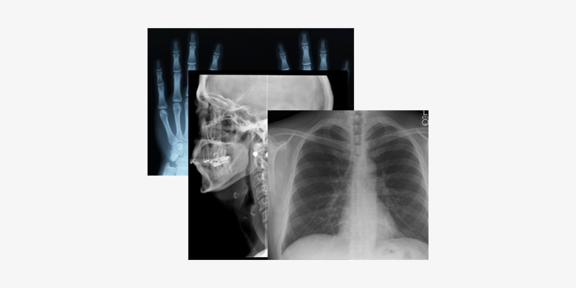 Xray - X Ray Transparent PNG - 400x330 - Free Download on NicePNG