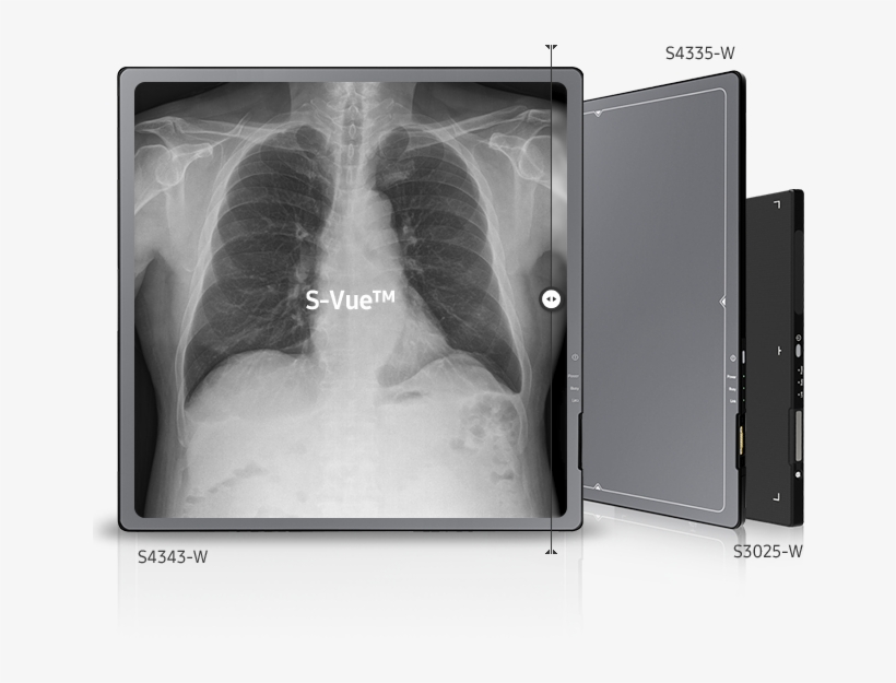 Radiography Transparent PNG - 653x616 - Free Download on NicePNG