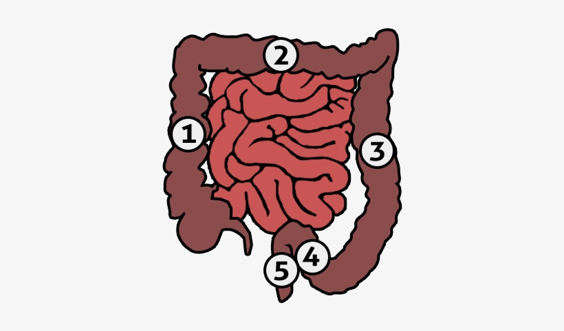 Human Colon - Different Types Of Ostomies And Locations Transparent PNG ...