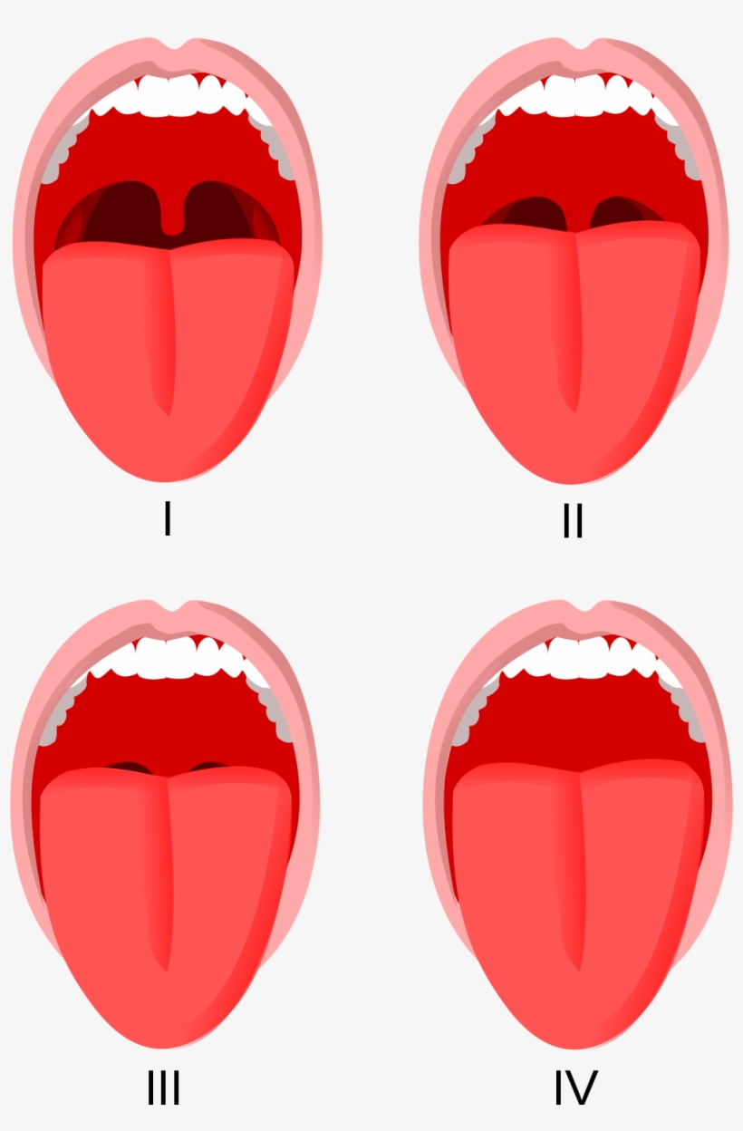 Download Escala De Mallampati Modificada - HD Transparent PNG - NicePNG.com