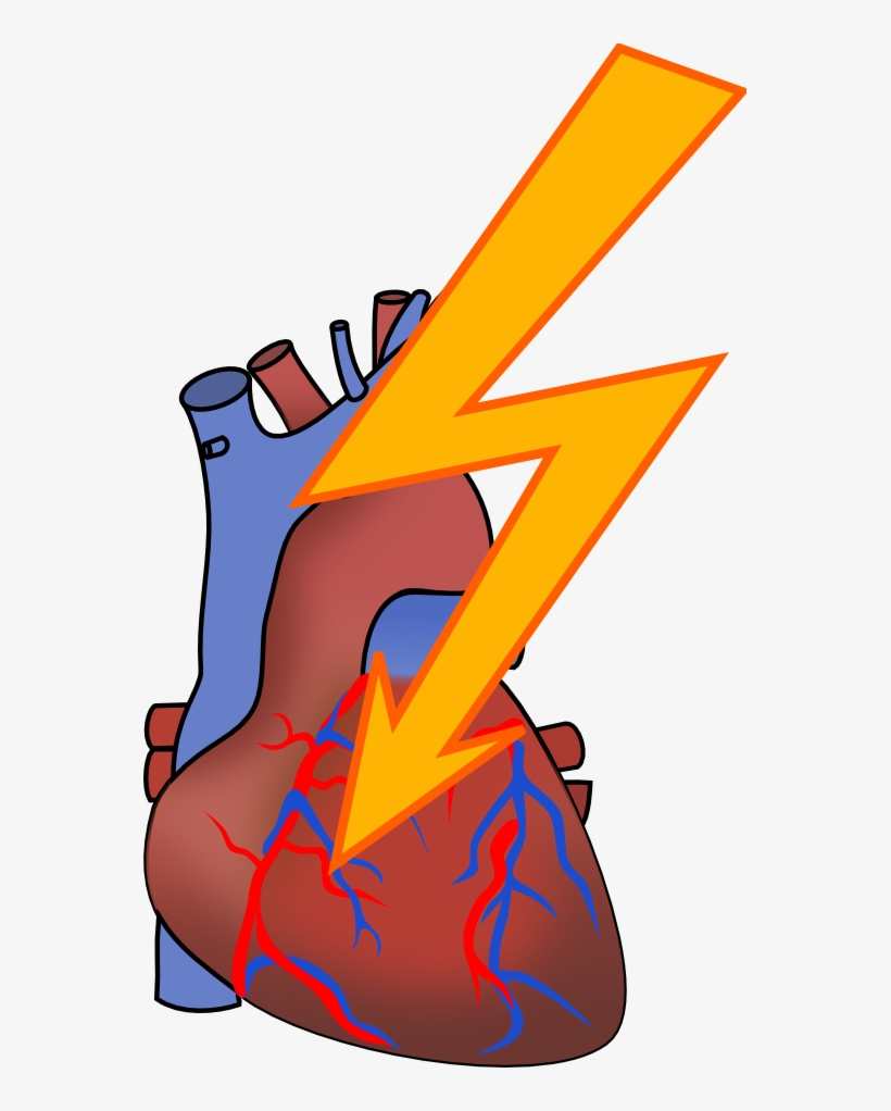 Heart - Heart Attack Clipart Png Transparent PNG - 555x942 - Free ...