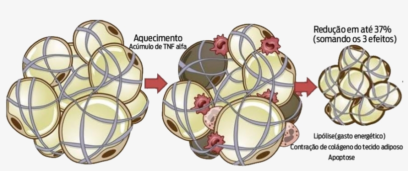 Efeito - Adipocytes Under Microscope Transparent PNG - 873x324 - Free ...