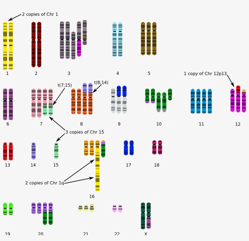 Download Breast Cancer Cell Karyotype - HD Transparent PNG - NicePNG.com