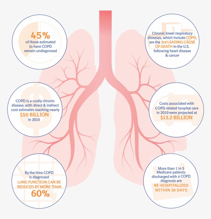 Chronic Lung Disease Statistics - Chronic Obstructive Pulmonary Disease ...