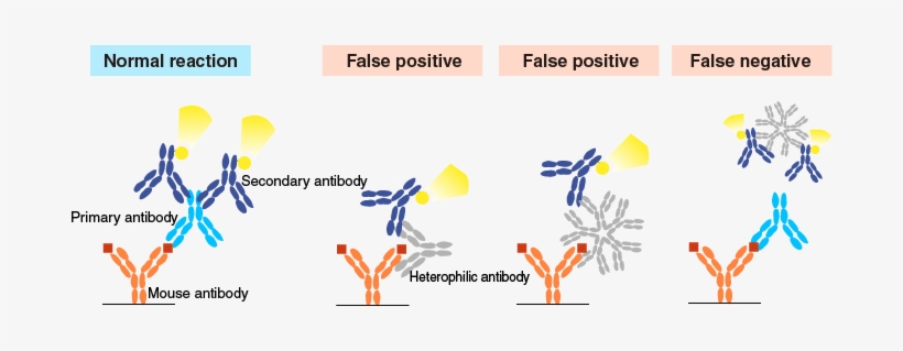 Heterophilic Antibodies - False Negative Heterophile Antibody ...
