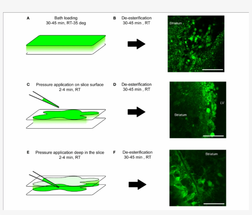 Loading Protocol Of Calcium Indicator Dyes - Brain Slice Calcium ...