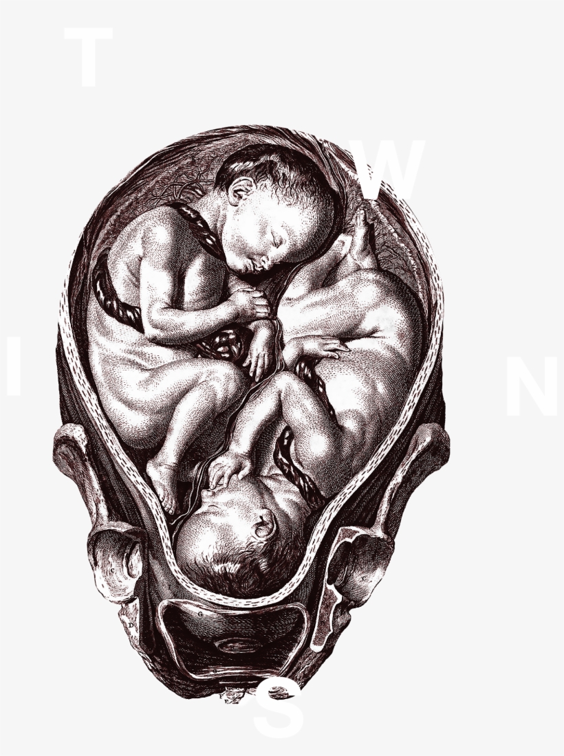 Library Anatomical Drawing Medieval - Munro Kerr's Operative Obstetrics ...