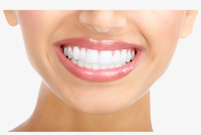 Free Clipart Buck Teeth