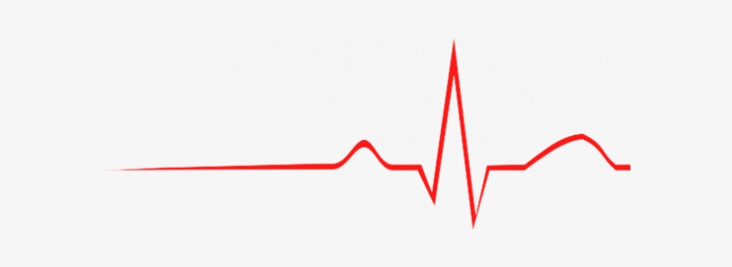 An Ecg Is A Measure Of The Electrical Output Of The ...