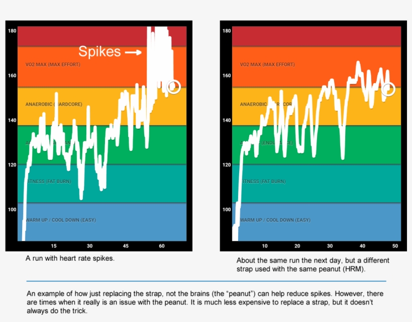 Ot Hrm Polar Belt Spikes - Heart Rate Spike Transparent PNG - 1125x851 - Free Download on NicePNG