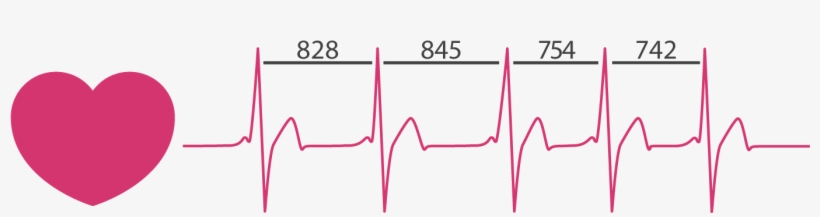 Download Heart Rate Variability Graph - Heart Rate Variability Analysis ...