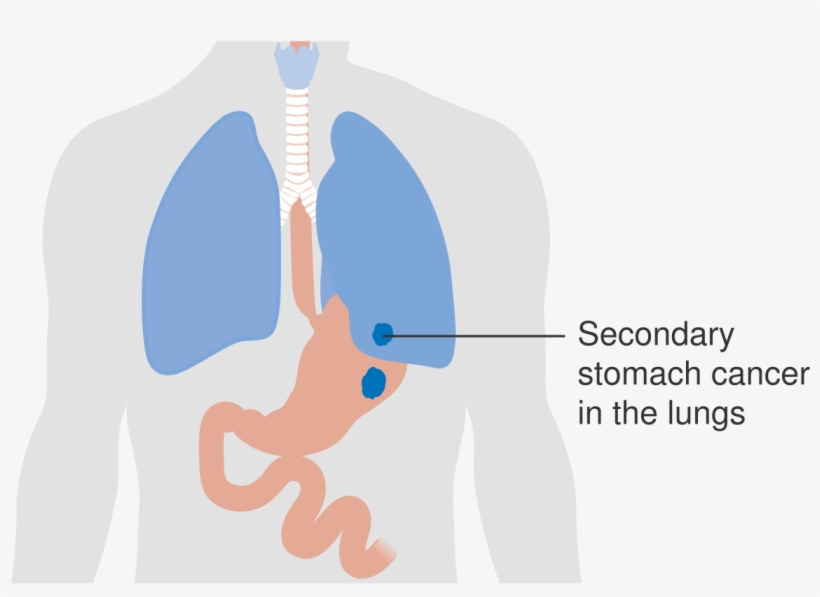 References - Illustration Transparent PNG - 1250x888 - Free Download on ...