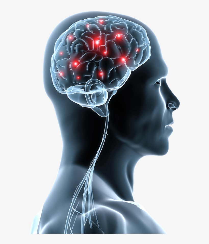 Change The Brain - Headaches Anatomy Transparent PNG - 675x900 - Free ...