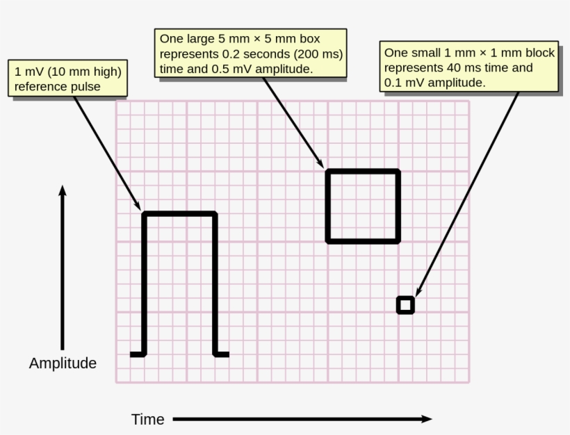 Ecg Paper V2 - Ecg Paper Speed Transparent PNG - 1280x933 - Free ...