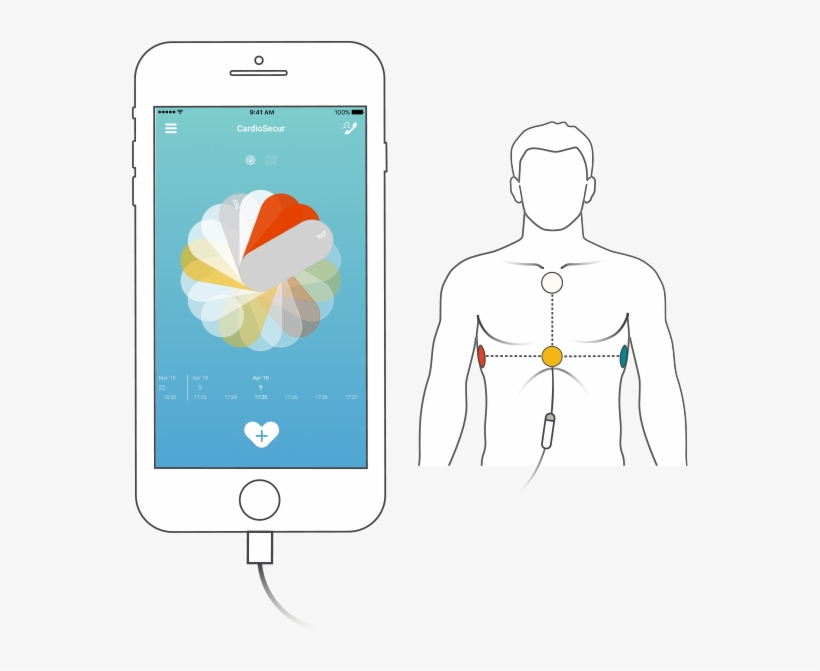 Starting The 10-second Ecg Recording In The Cardiosecur - Iphone ...