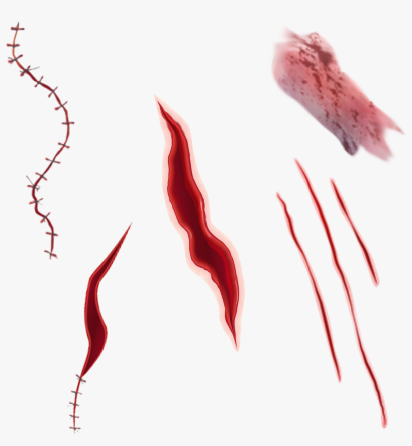 Download #freetoedit #blood #injury #scar #png - Illustration - HD ...