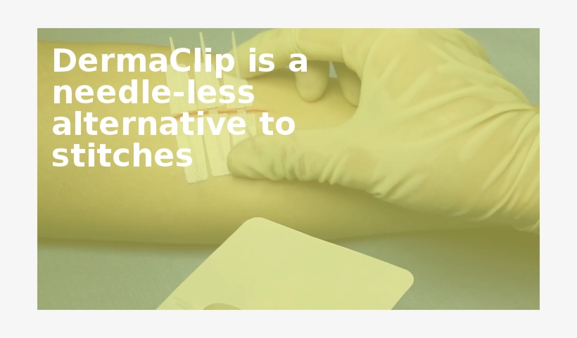 Dermaclip Is A Needle-less Alternative To Stitches - Comfort ...