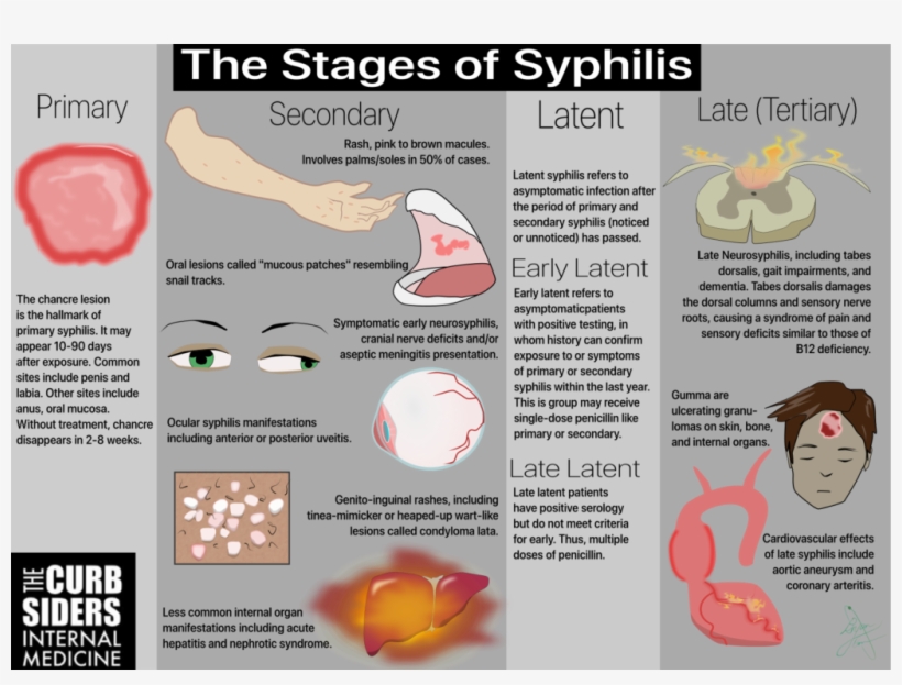 Download Infographic The Curbsiders 127 Stis Stages Of Syphilis ...