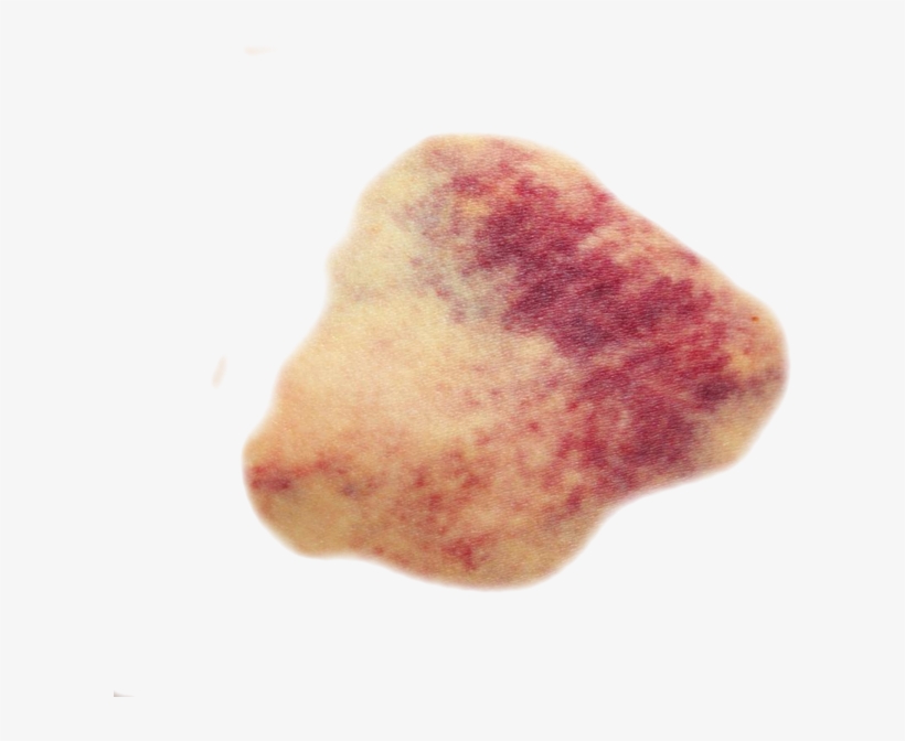 Bruise - Gym Transparent PNG - 742x600 - Free Download on NicePNG