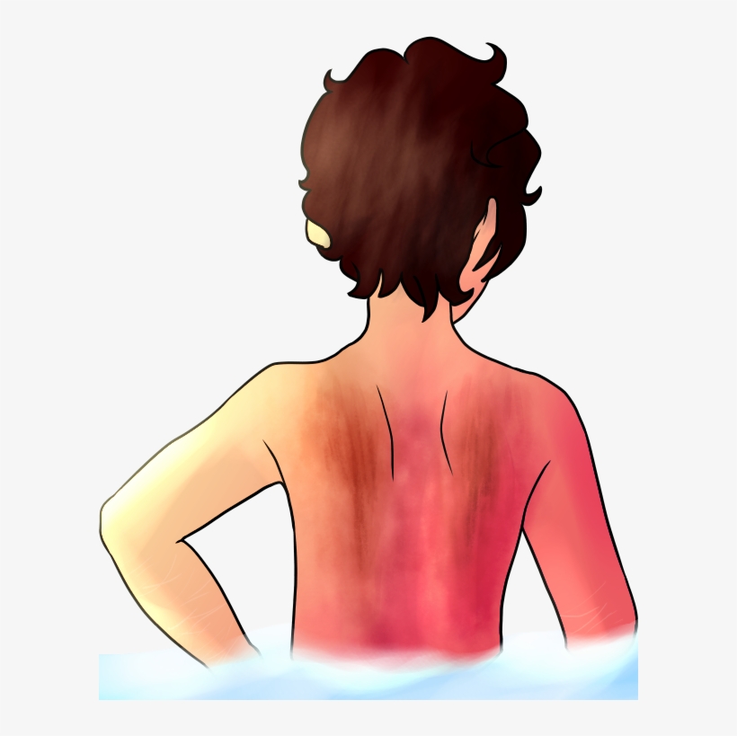 the Angel＇s Scars】 - Illustration Transparent PNG - 600x739 - Free ...