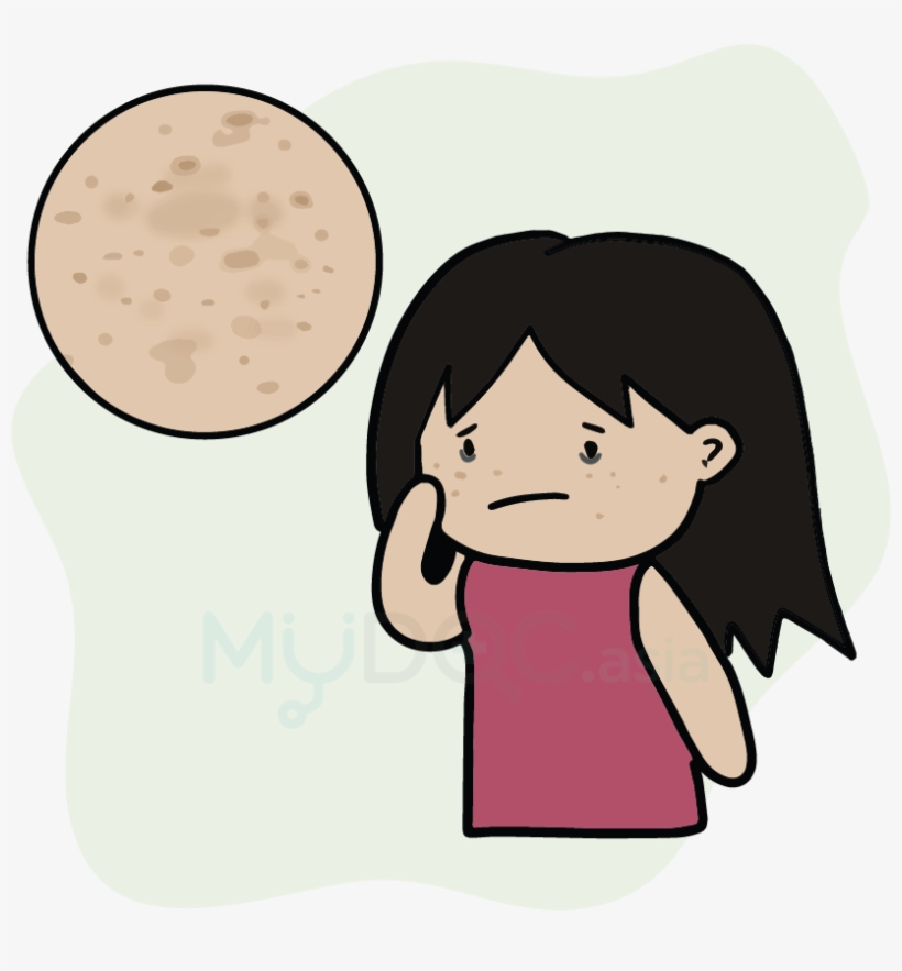 Eye Patch Clipart Translucent - Cartoon Transparent PNG - 815x803 ...