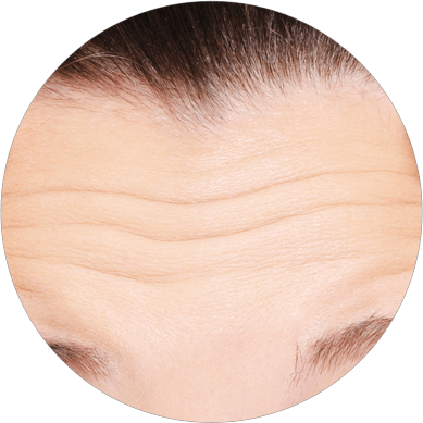 Download Forehead Wrinkles - Plywood - HD Transparent PNG - NicePNG.com