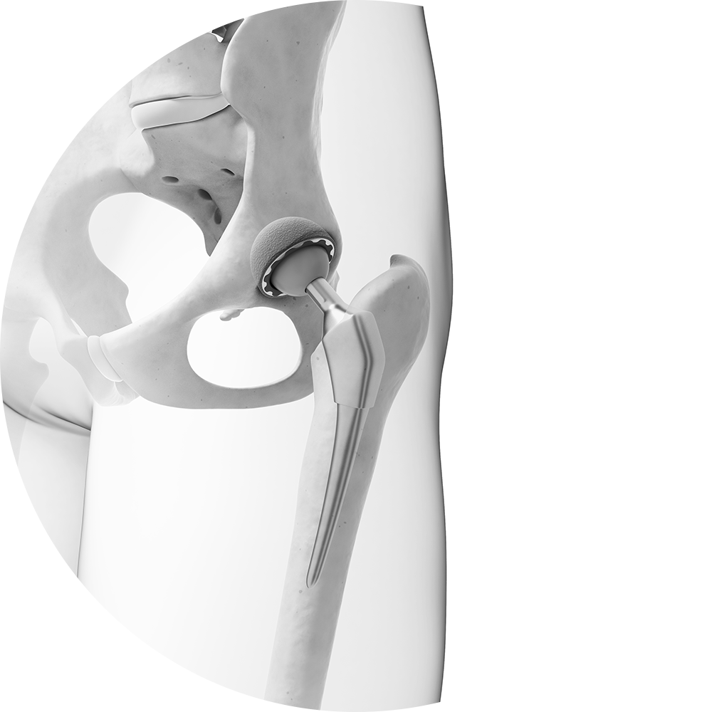 Download HD Img Hip Transparent PNG Image - NicePNG.com