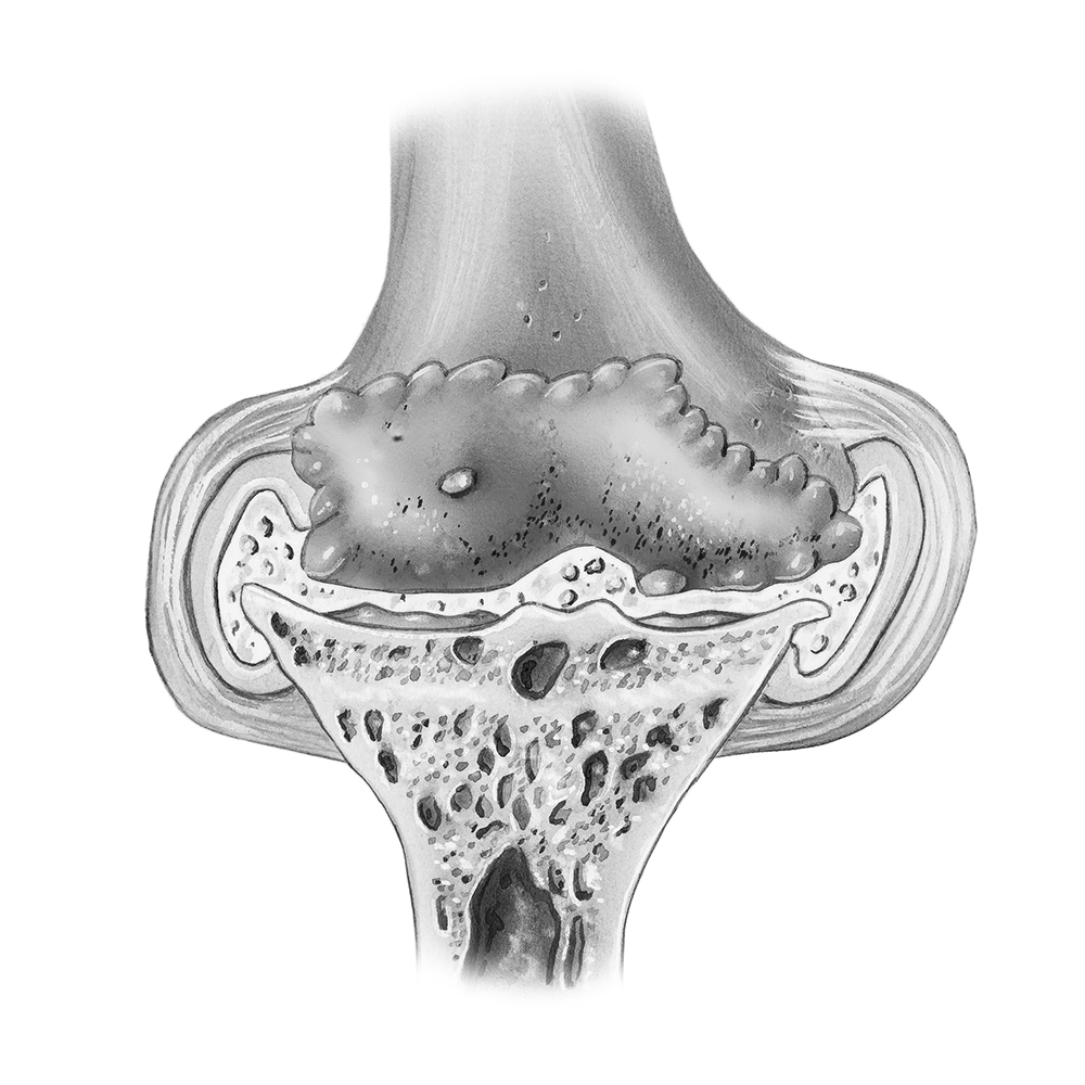 Download HD Img Knee Transparent PNG Image - NicePNG.com