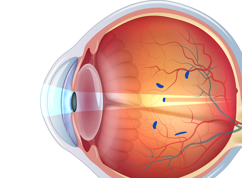 Download Structure Of Human Eye Without Label - HD Transparent PNG ...