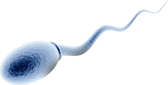 Download Diagnosis Of Male Infertility By Sperm Rna Elements ...