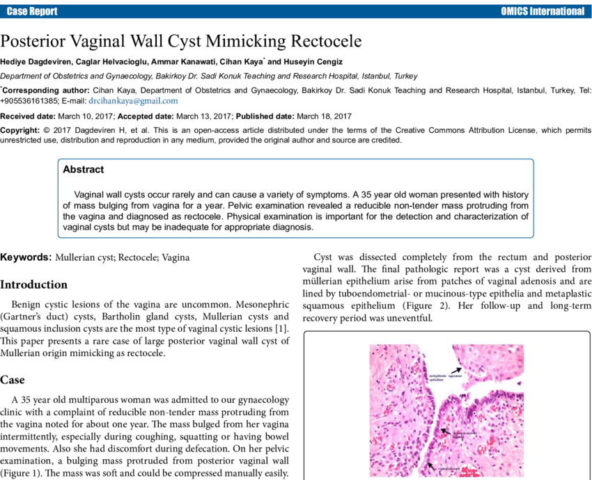 Download HD Histopathologic Findings Of Vaginal Cyst - Vaginal Cysts ...